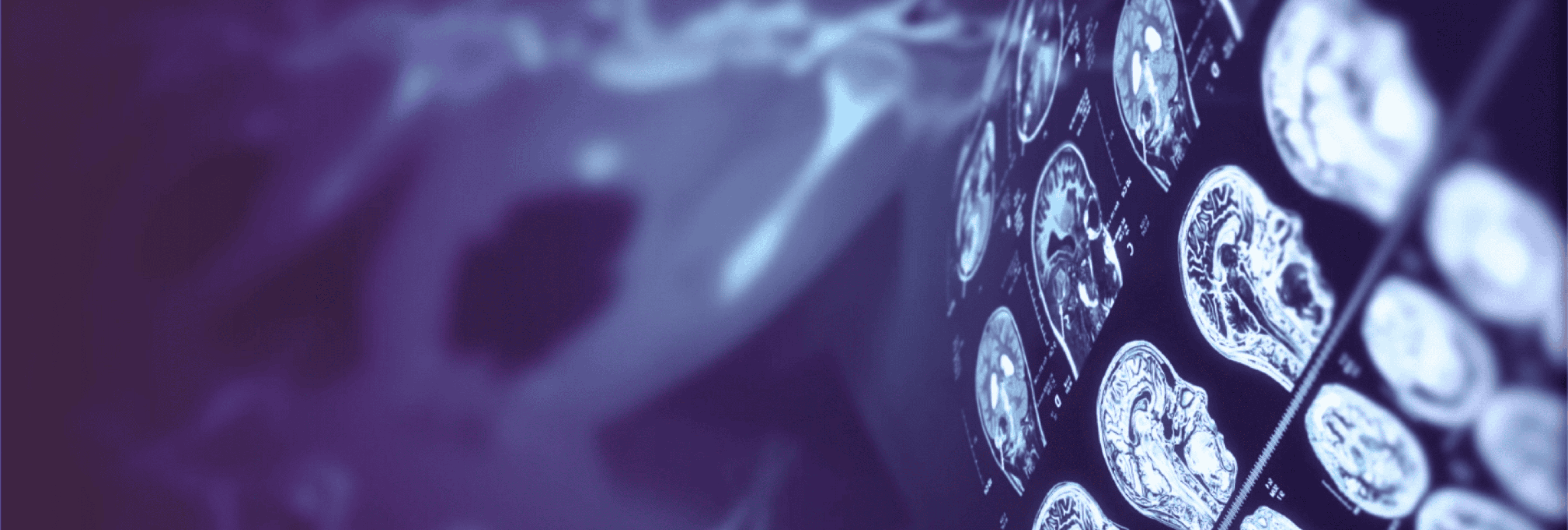 Outsourcing Europe | BPO Company Ukraine | Mindy Support