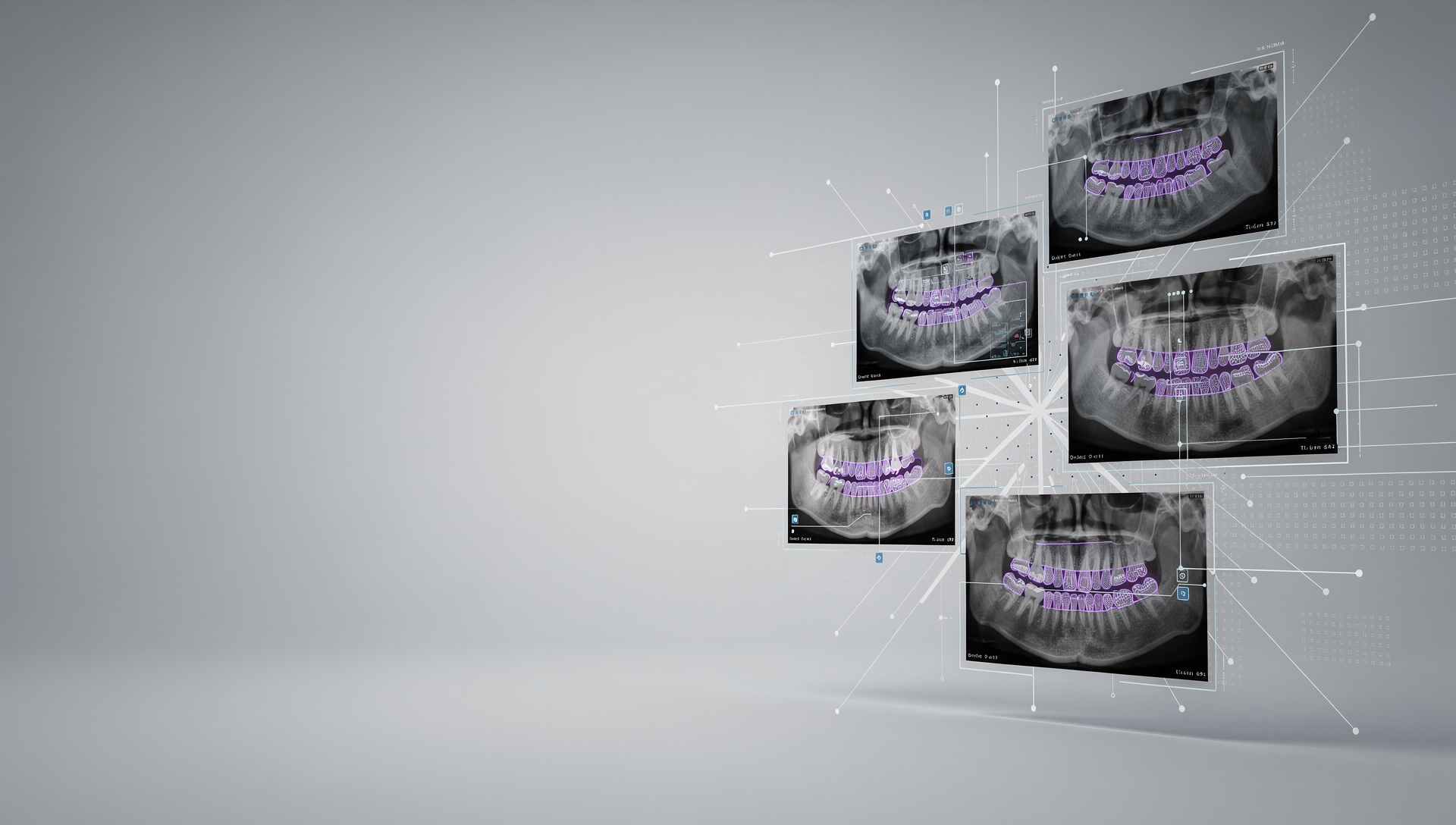 Large-Scale Dental X-ray Annotation for AI Diagnostics | 25,000+ Images